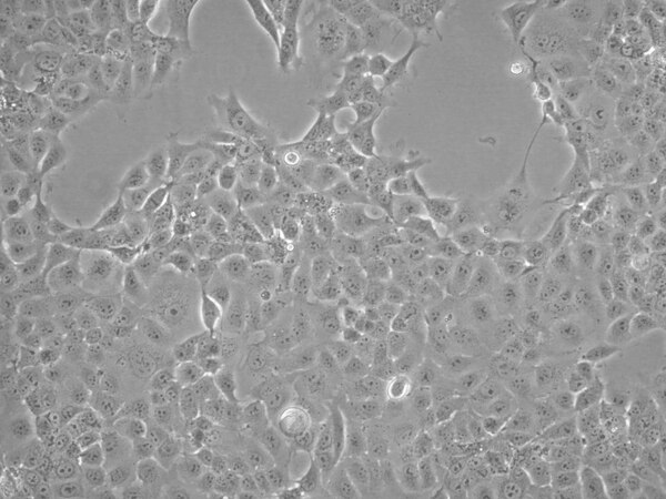 HCC827 GR6 Human Lung Adenocarcinoma Cell Line | SCC426